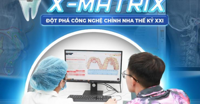 Niềng răng mắc cài nhân đôi hiệu quả với công nghệ X-Matrix