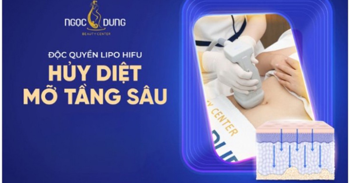 Lipo Hifu - Bí quyết giảm mỡ bụng tại TMV Ngọc Dung