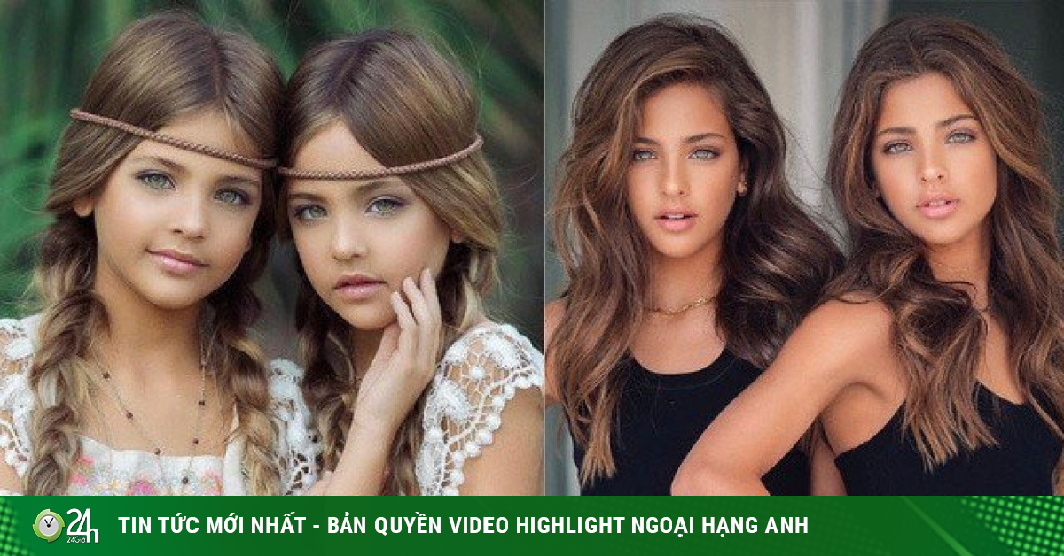 Cặp song sinh đẹp nhất thế giới có đôi mắt hút hồn triệu người, 13 năm ...